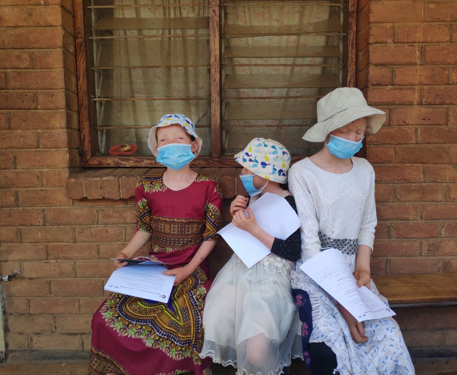 10 things you may not know about albinism - Beyond suncare