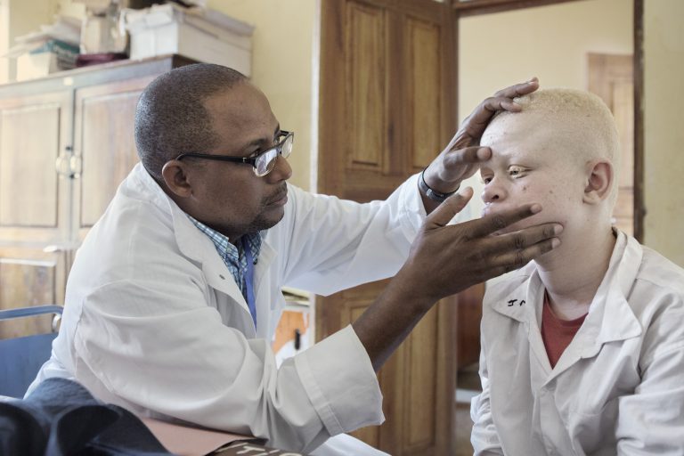 10 things you may not know about albinism - Beyond suncare